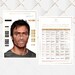 Botox Cheat Sheets for Injection Depth With Facial Muscles Anatomy ...