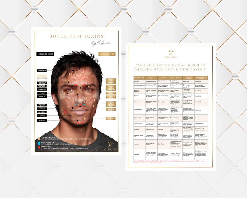Botox Cheat Sheets for Injection Depth With Facial Muscles Anatomy ...