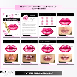 Hyaluron Pen Lip Mapping, Lip Filler Map, Russian Lip Technique, Cupid ...