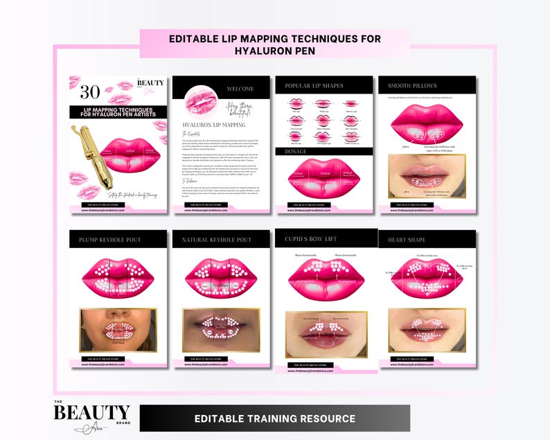 Hyaluron Pen Lip Mapping, Lip Filler Map, Russian Lip Technique, Cupid ...