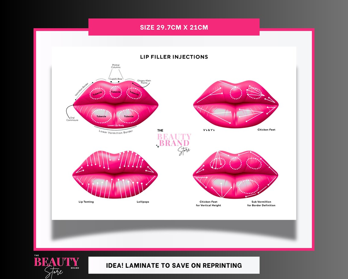 Lip Filler Practice Injection Techniques Template, PDF, JPG ...