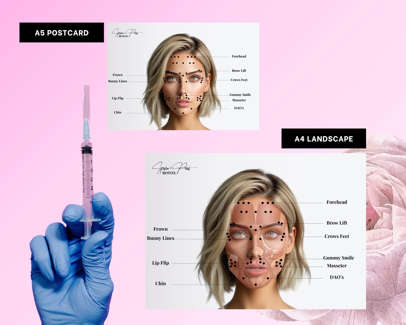 Botox Injection Points, Botox Injectors, Facial Anatomy, Art ...