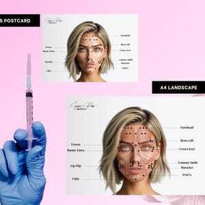 Botox Injection Points, Botox Injectors, Facial Anatomy, Art ...