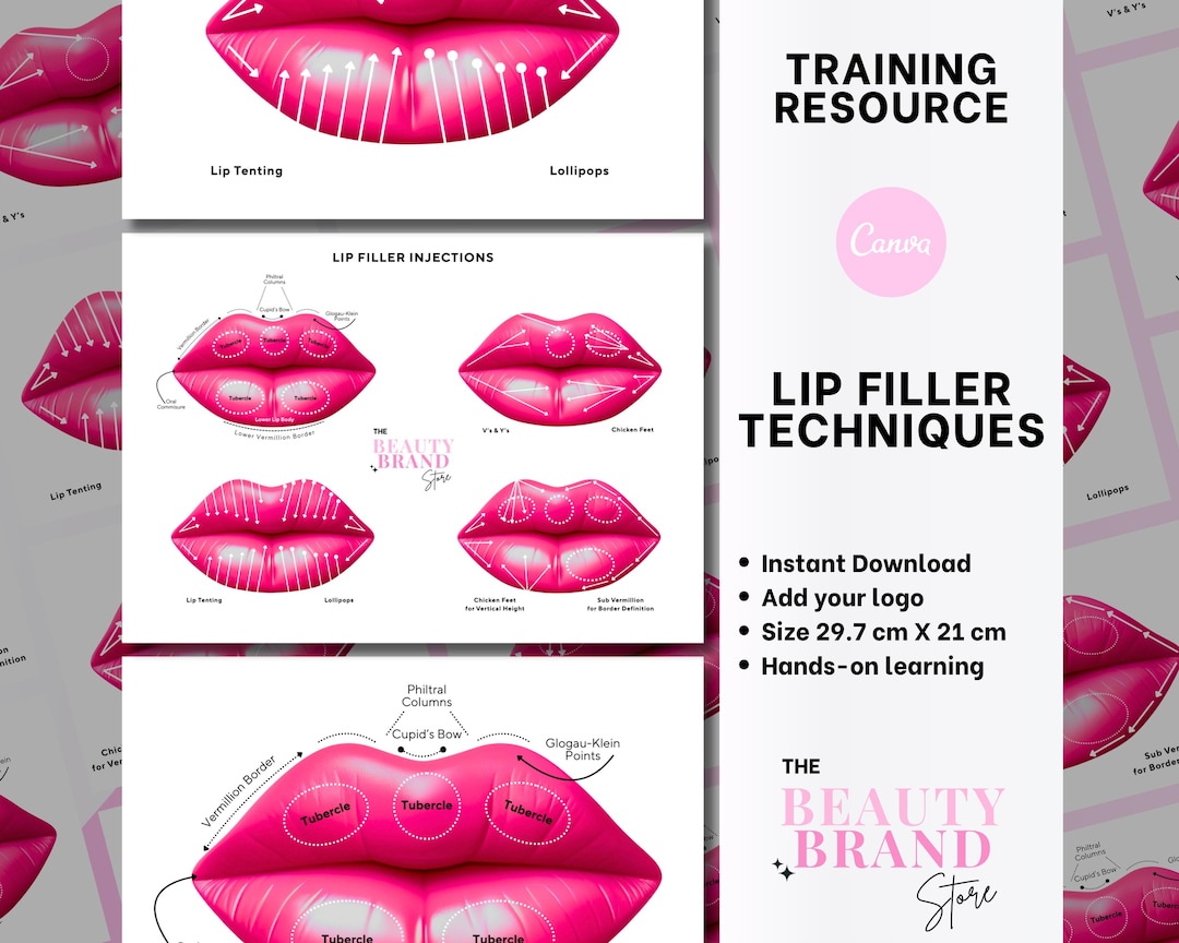 Lip Filler Practice Injection Techniques Template, PDF, JPG ...