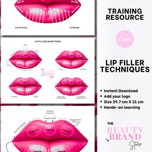 Lip Filler Practice Injection Techniques Template, PDF, JPG ...