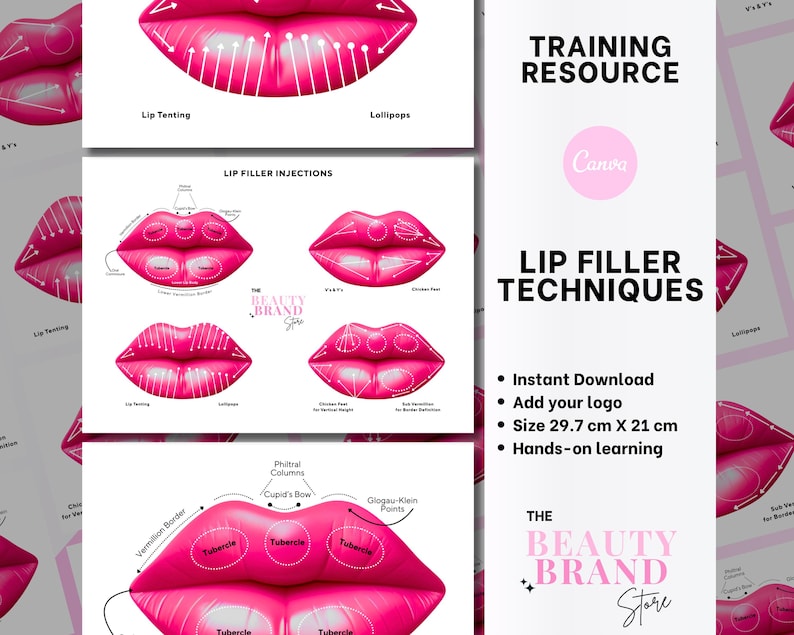 Lip Filler Practice Injection Techniques Template, PDF, JPG ...