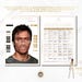 Botox Cheat Sheets for Injection Depth With Facial Muscles Anatomy ...