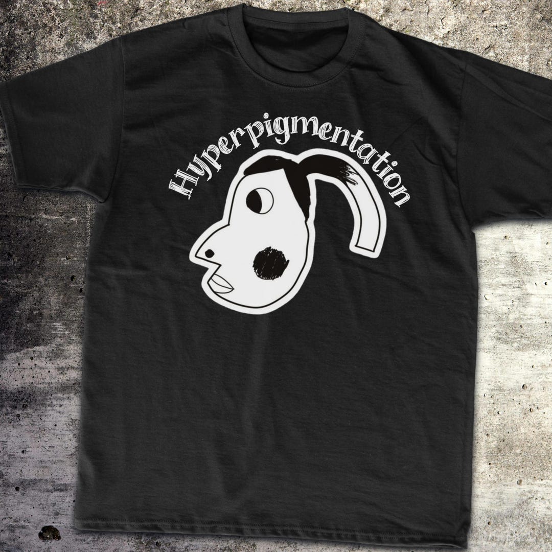 Funny Hyperpigmentation Meme Unisex Tee, Hilarious Offensive Vintage ...