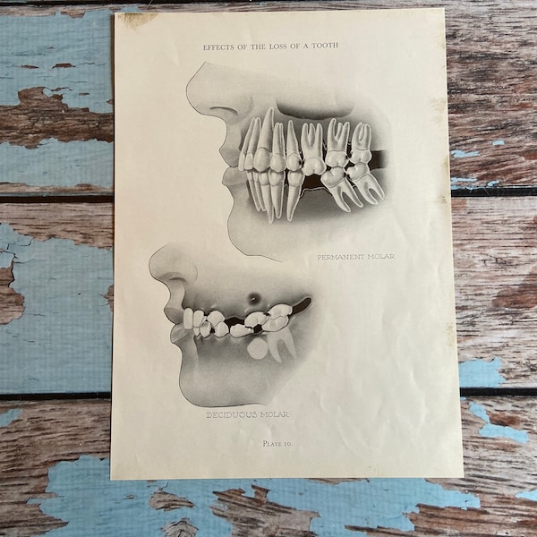 Dentist Picture Frame - Etsy