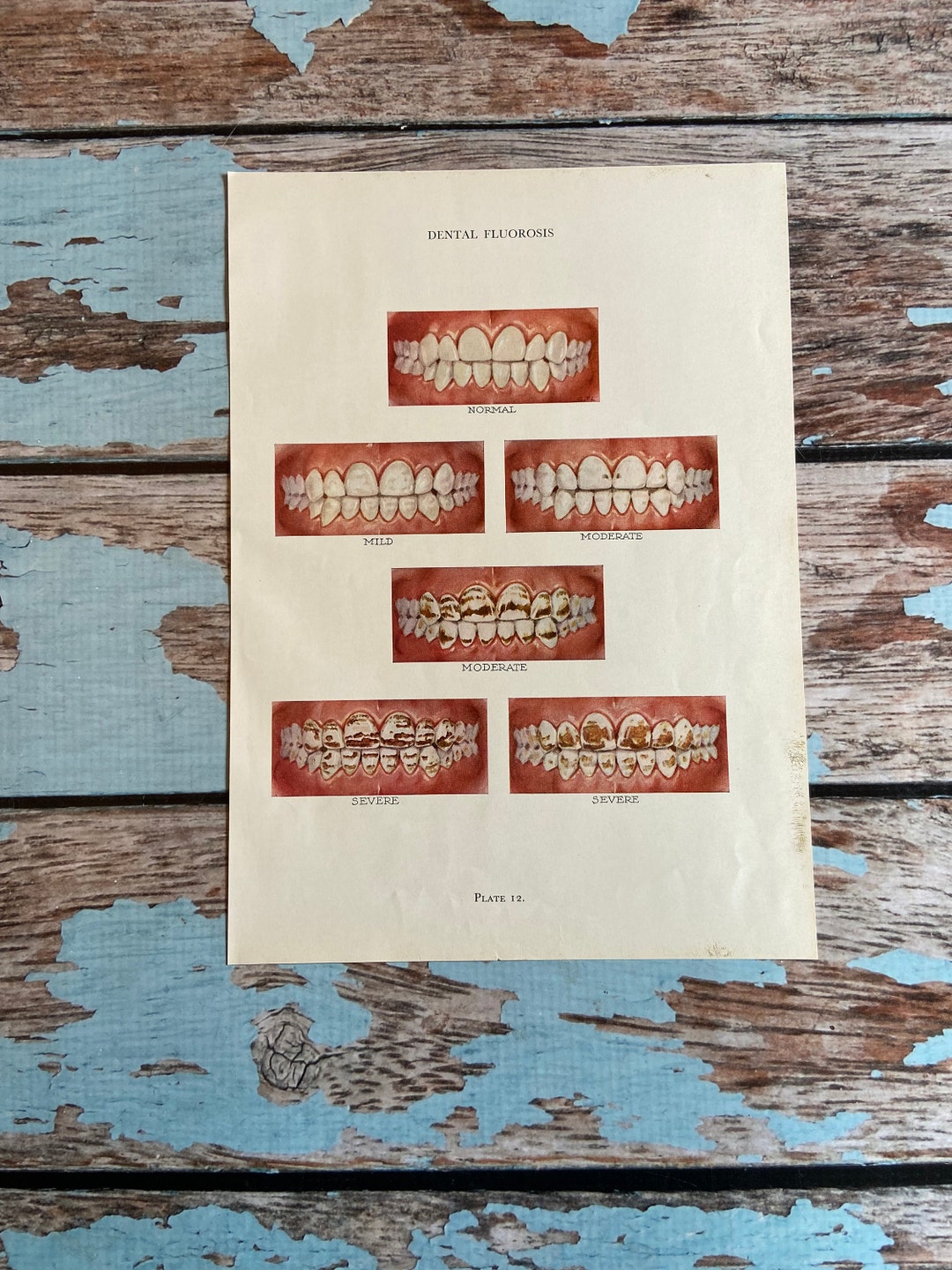 Vintage TEETH MOUTH Medical Print. Full Color Lithograph to Frame. 1952 ...