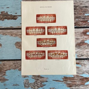 Vintage TEETH MOUTH Medical Print. Full Color Lithograph to Frame. 1952 ...