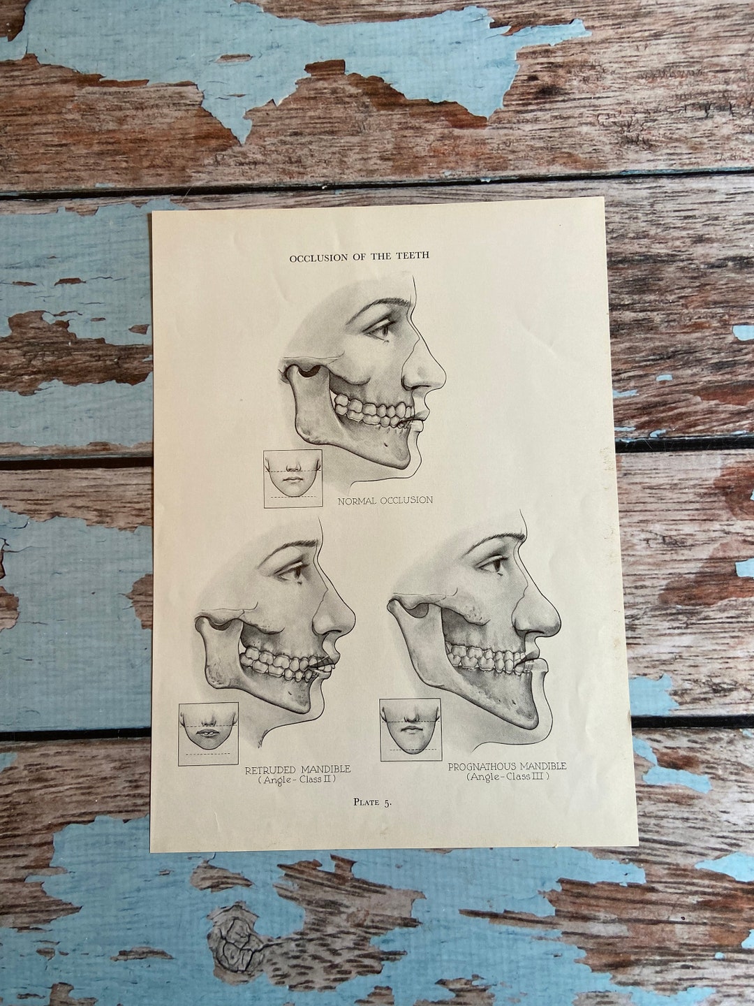 Vintage TEETH MOUTH Medical Print. Black & White Lithograph to Frame ...
