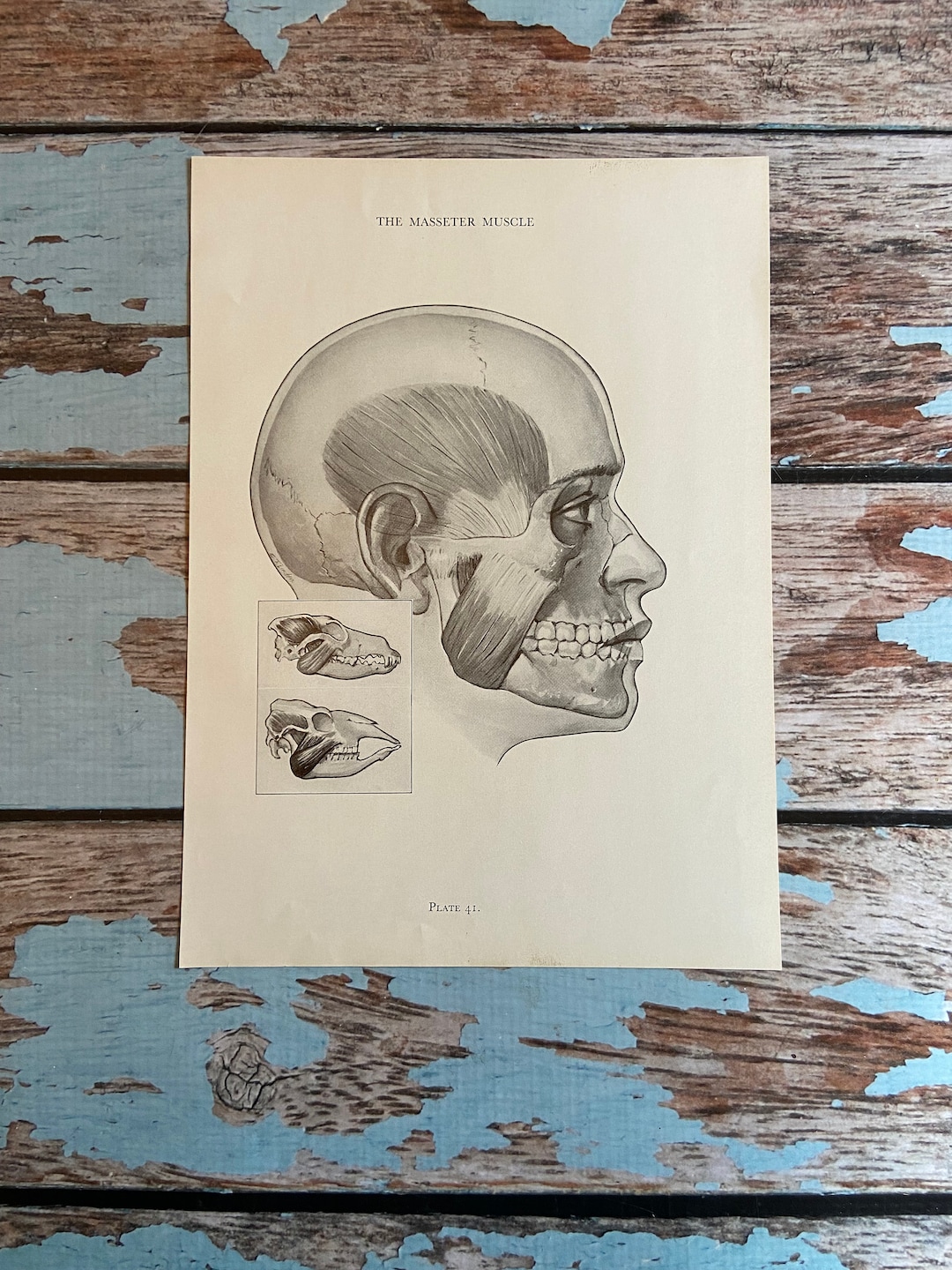 Vintage SKULL Medical Print. the Masseter Muscle. TMJ. Black & White ...