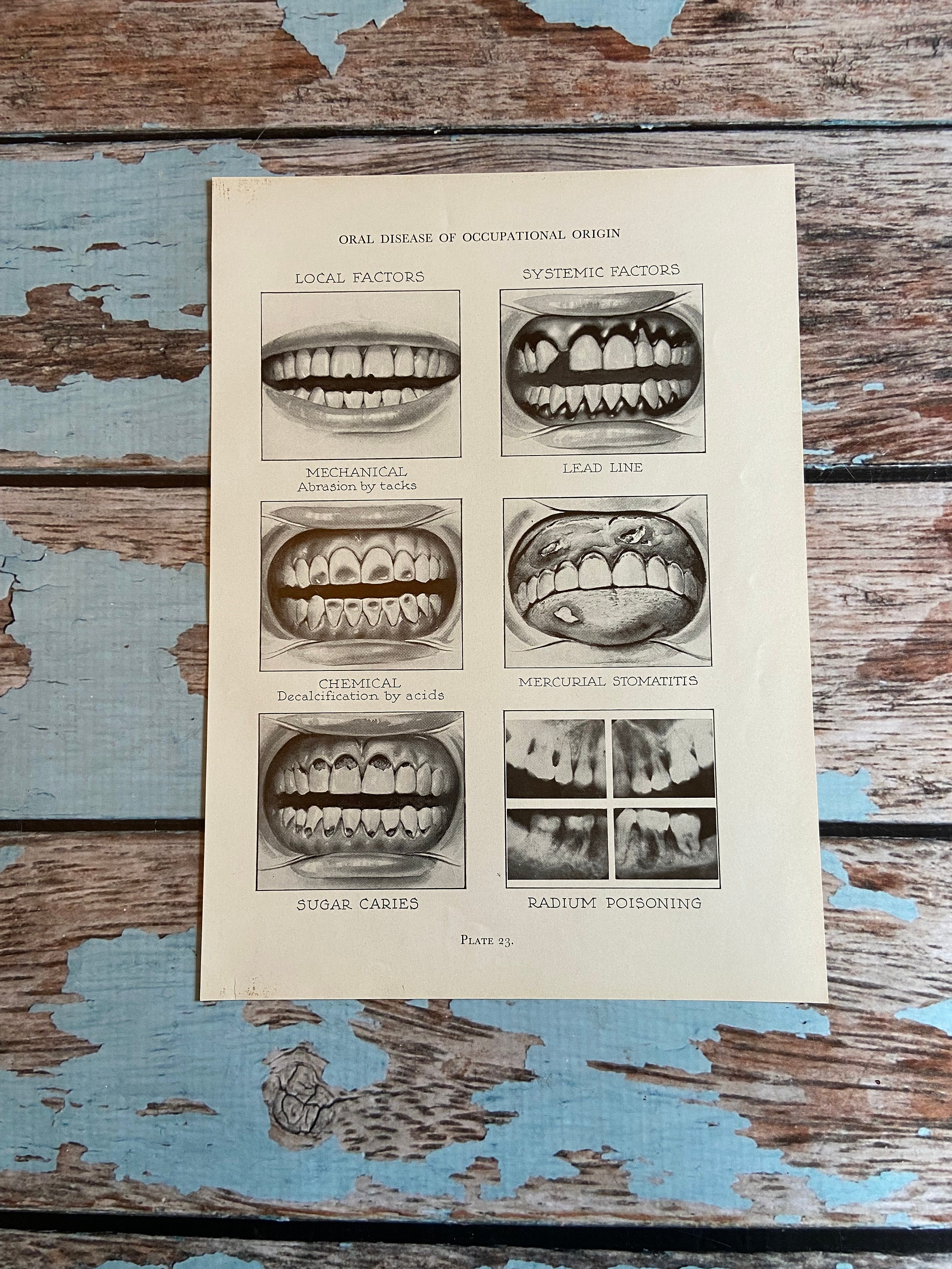 Prints Art & Collectibles Oral Cavity Oddity Dentist Oral Surgeon ...