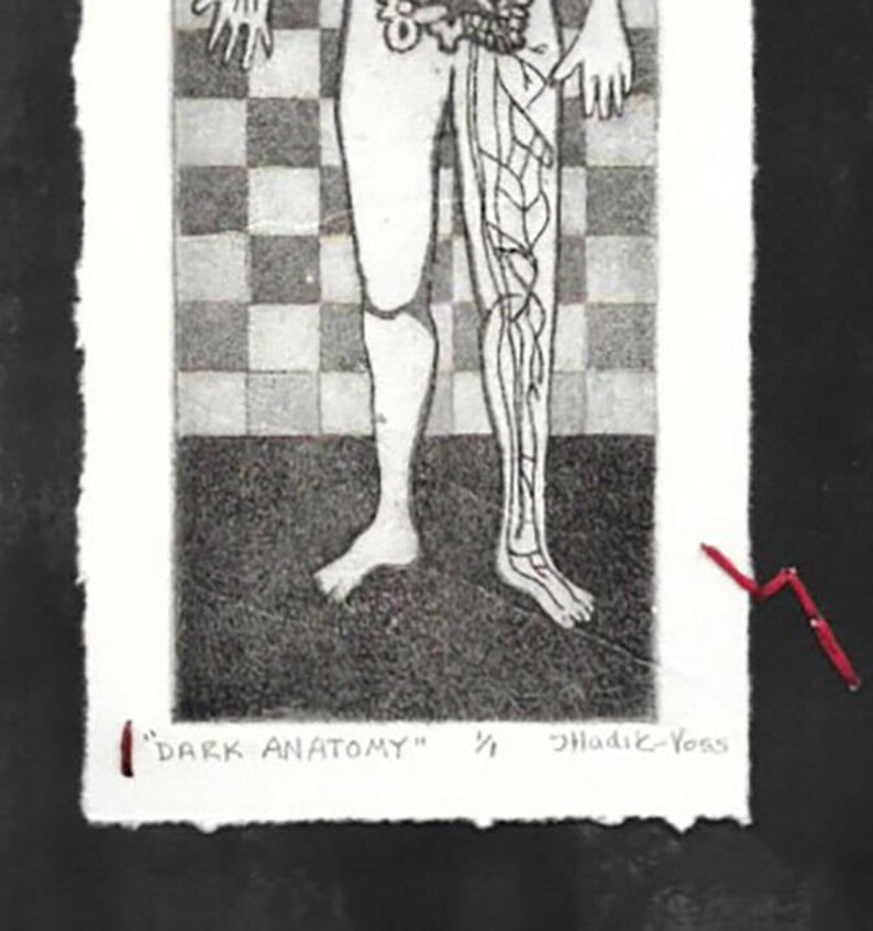 Dark Anatomy Aquatint Etching-biology Geekery Medical Science-monoprint ...