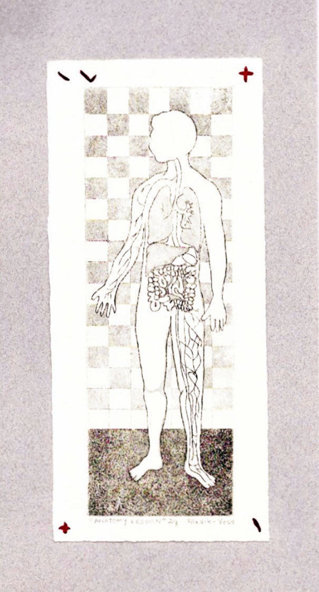 Anatomy Lesson Aquatint Etching- Edition of 3- Science Biology Geekery ...