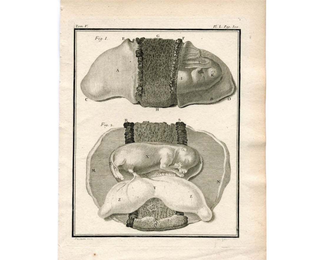 C. 1777 DOG FETUS Engraving • in Utero • Original Antique Print ...