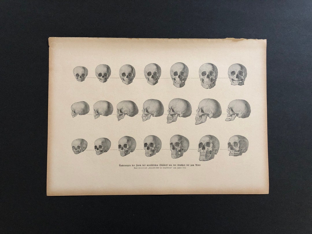 SKULLS Print C. 1900 • Original Antique Print • Antique Skeleton Print ...