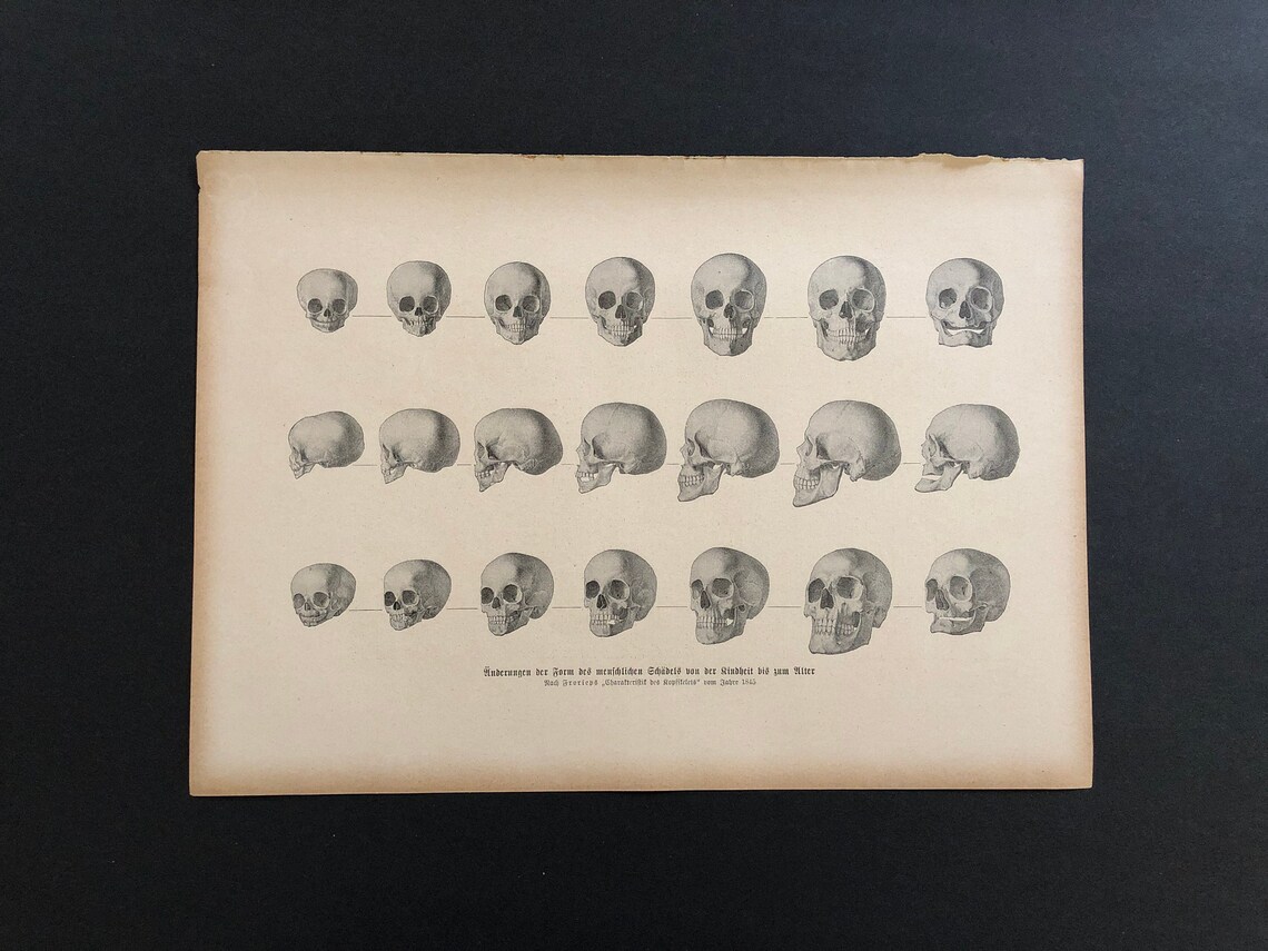 SKULLS Print C. 1900 • Original Antique Print • Antique Skeleton Print ...