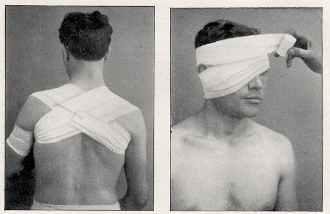 1901 WOUND DRESSING & CARE of Wounds Print Original Antique Medical ...