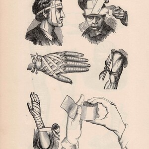 1903 BANDAGES - MEDICAL DRESSING Lithographs - Original Antique Prints ...