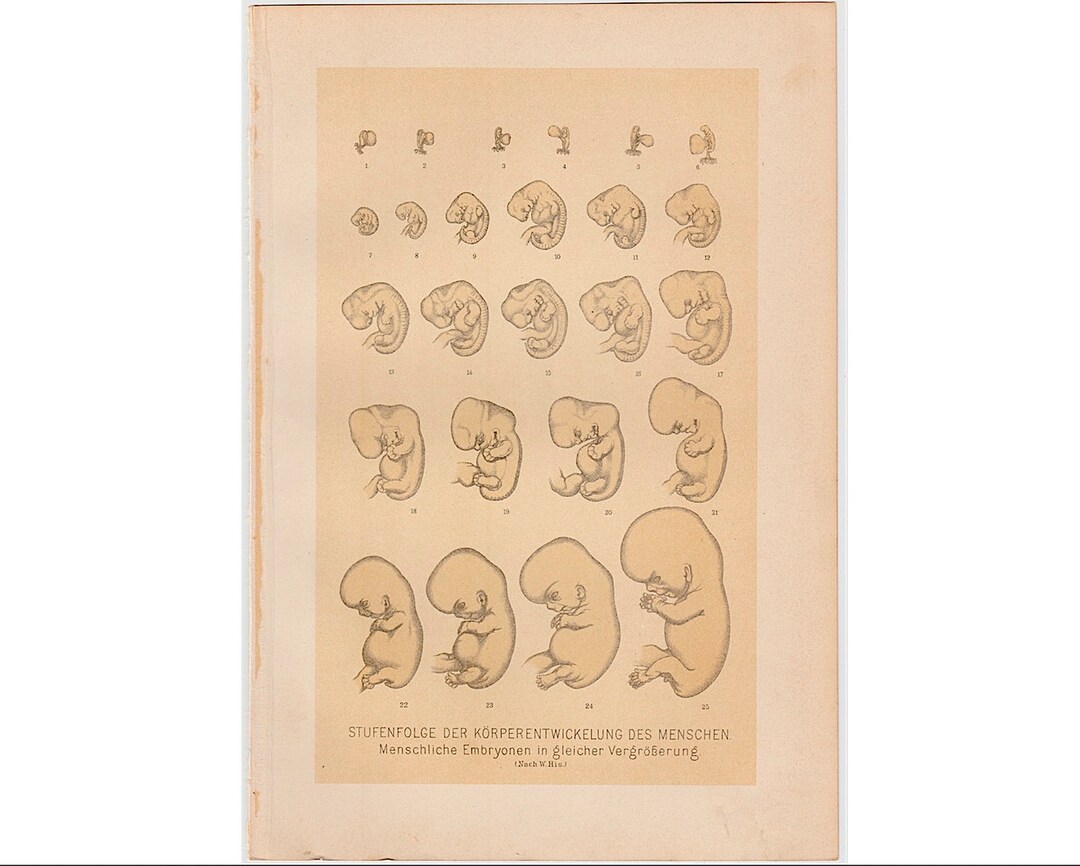 C. 1898 HUMAN EMBRYO DEVELOPMENT Lithograph • Original Antique Print ...