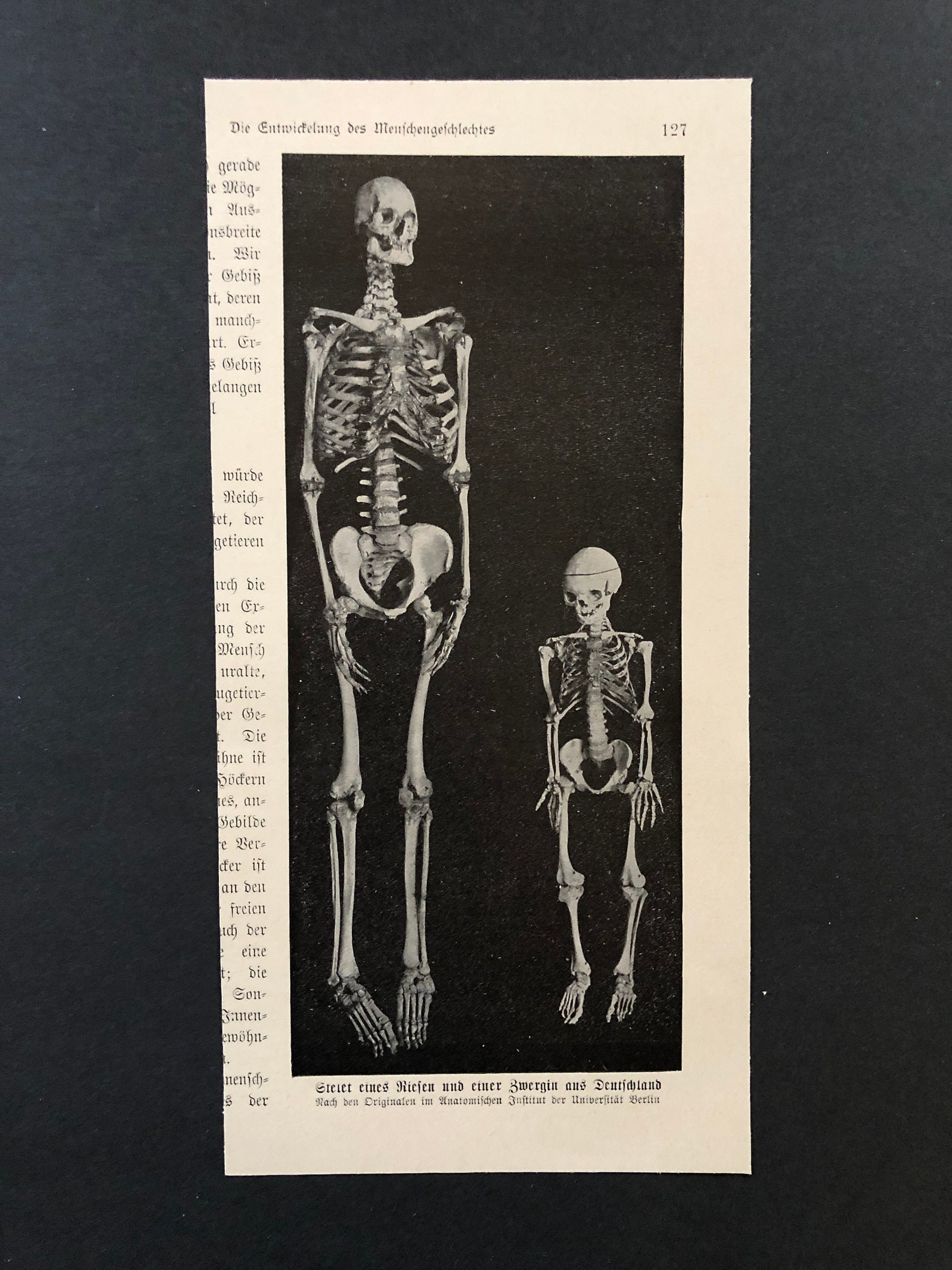 HUMAN SKELETONS Print C. 1900 • Original Antique Print • Antique ...