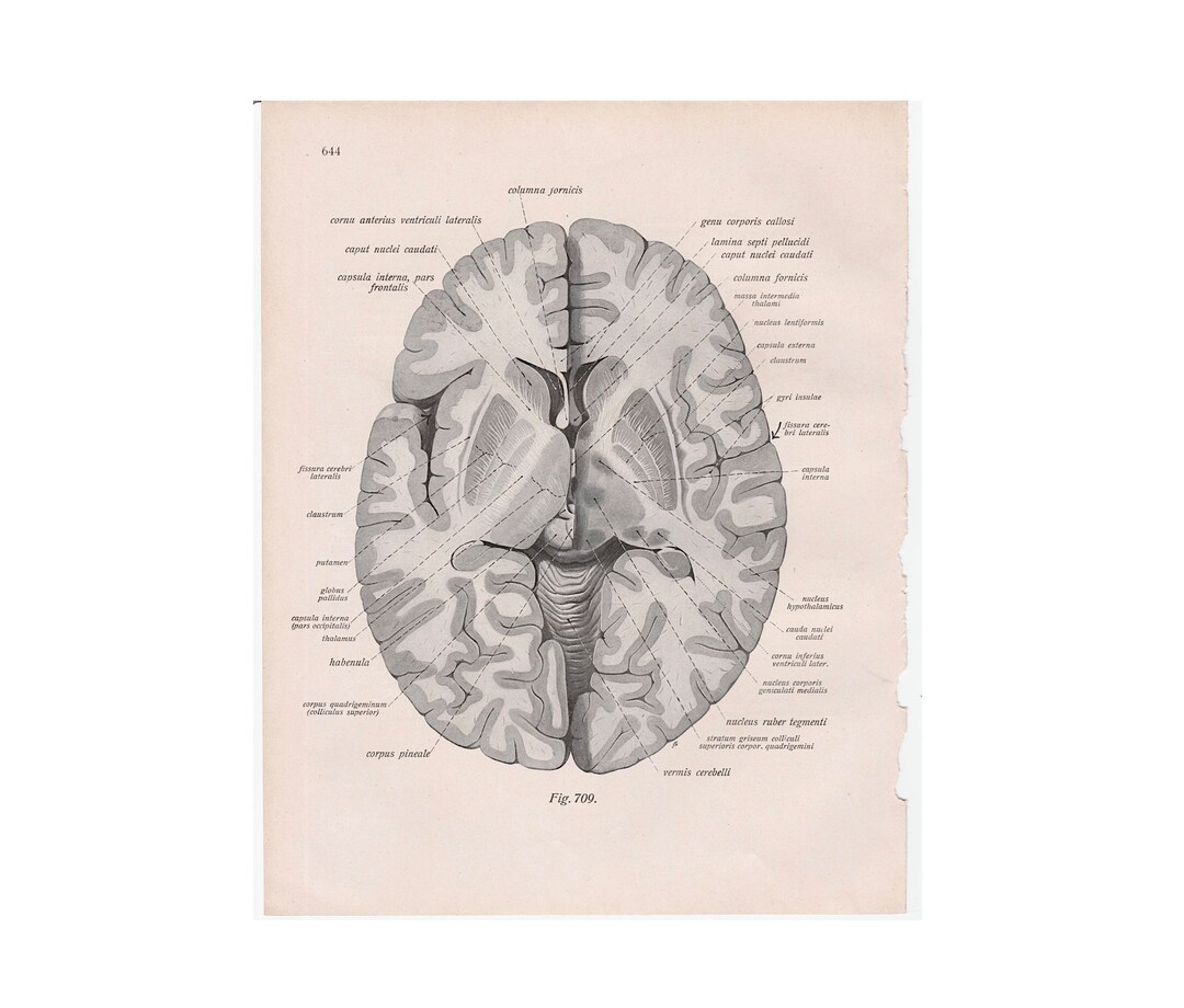 C. 1922 BRAIN SLICE Lithograph • Original Antique Print • Brain Anatomy ...