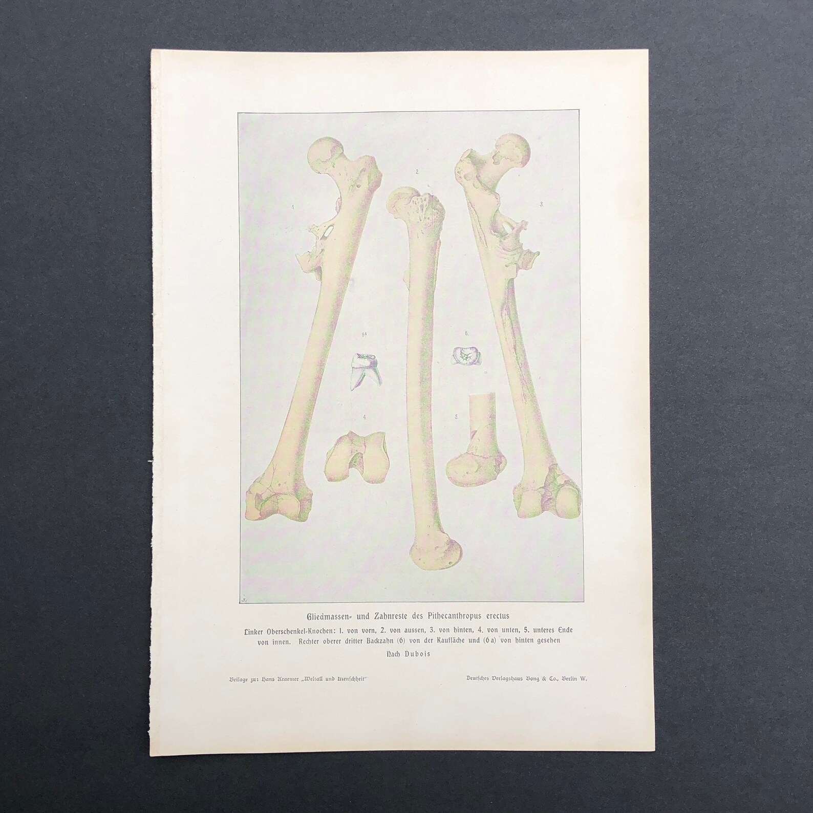 C. 1900 BONES PRINT Antique Anatomy Print Human Skeleton - Etsy