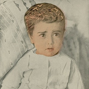 1906 Scald Head Human Anatomy Original Antique Disease Print - Etsy