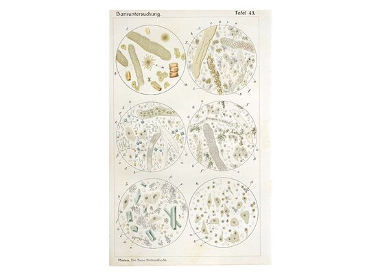 C. 1896 URINE UNDER MICROSCOPE Lithograph Original Antique - Etsy