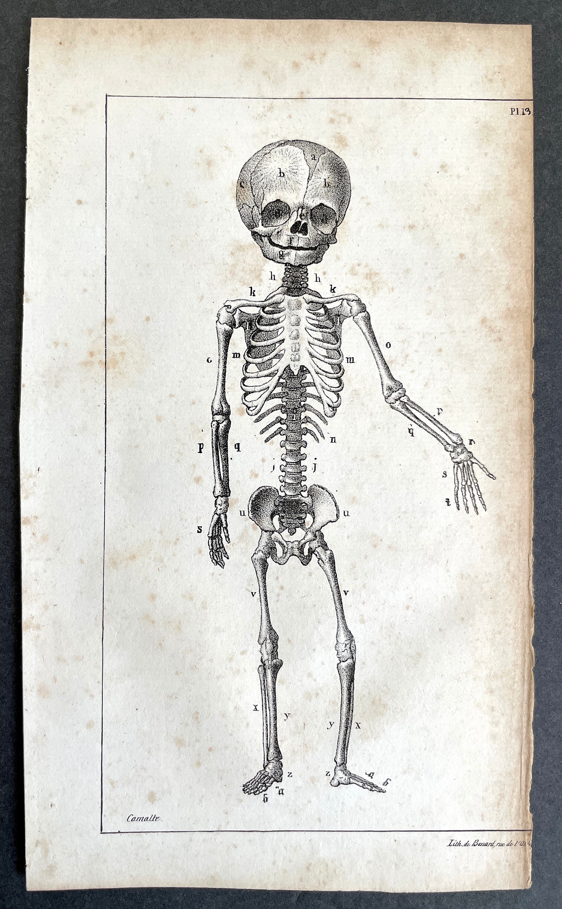 FETUS SKELETON Lithograph C. 1835 • Original Antique Print • Fetal ...