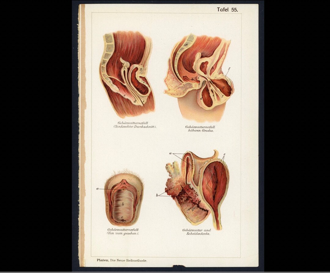C. 1902 FEMALE ANATOMY Lithograph • Original Antique Print • OBGYN ...