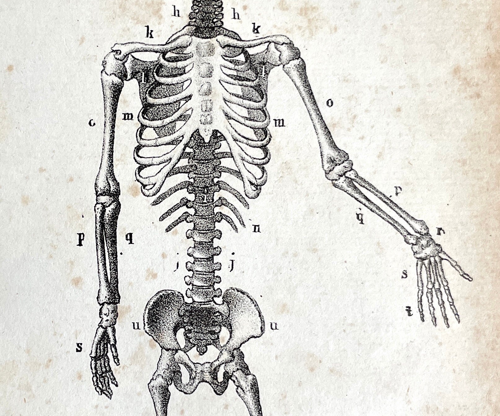 FETUS SKELETON Lithograph C. 1835 • Original Antique Print • Fetal ...