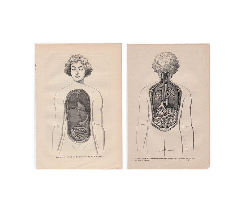 FEMALE INTERNAL ORGANS Lithographs C. 1896 • Original Antique Prints ...