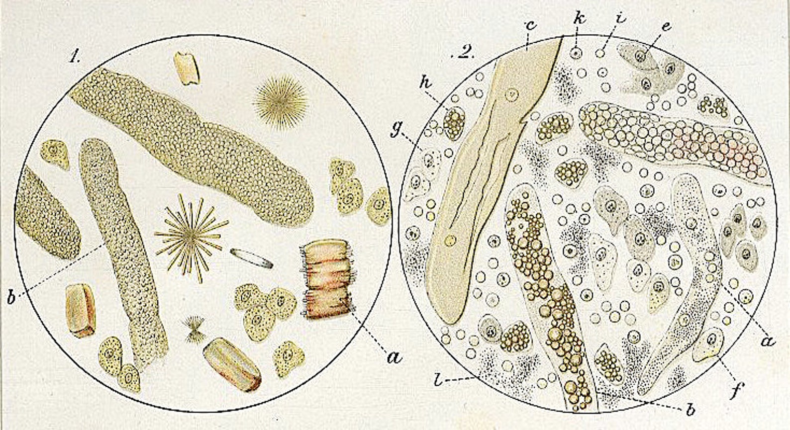 C. 1896 URINE UNDER MICROSCOPE Lithograph Original Antique - Etsy