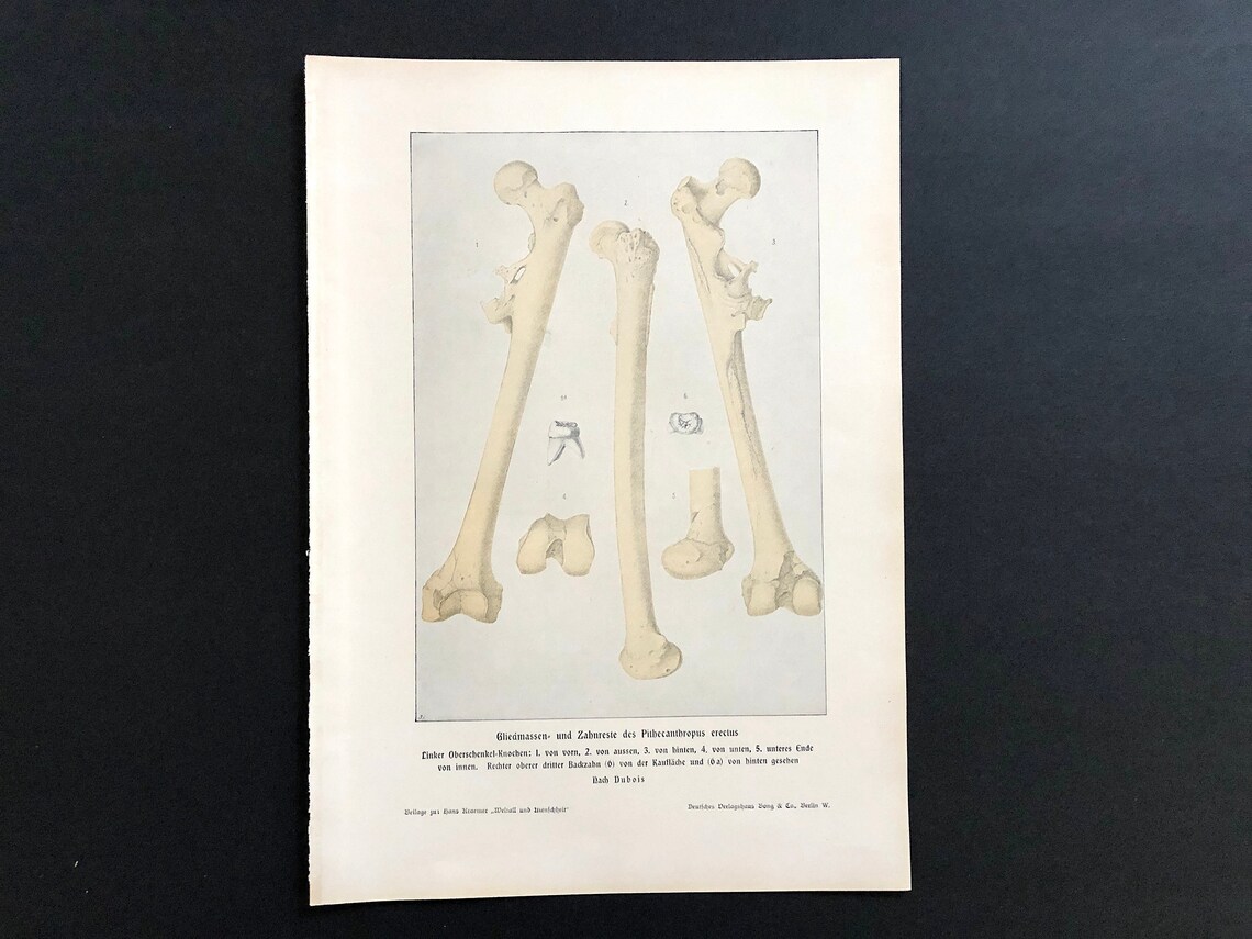 C. 1900 BONES PRINT - Antique Anatomy Print - Human Skeleton Print ...