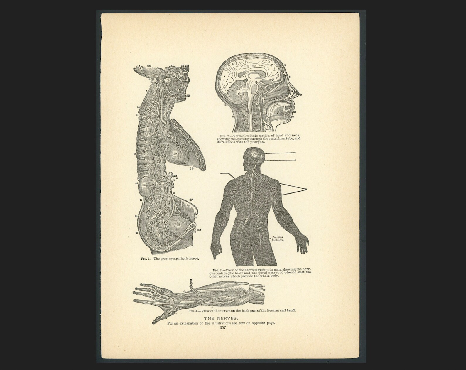 C. 1901 NERVOUS SYSTEM Lithograph • Original Antique Print • Medical ...
