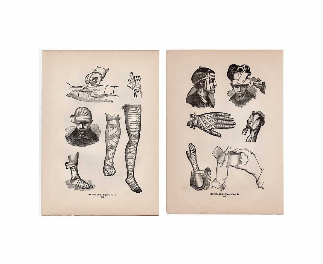 BANDAGES & MEDICAL DRESSING Prints C. 1903 - Original Antique Prints ...