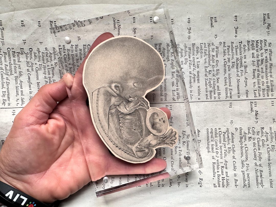 Framed ANTIQUE FETUS PRINT C. 1900 • Original Antique Print • Medical ...