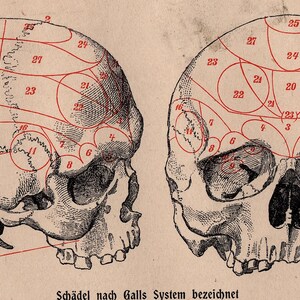 HUMAN SKULL Print C. 1900 • Original Antique Print • Antique Skeleton ...