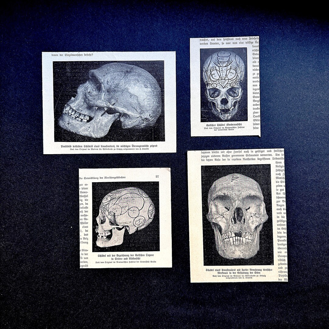 C. 1900 SKULL Lithographs • Set of 4 Original Antique Prints • Human ...