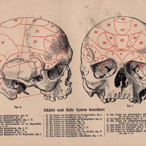 HUMAN SKULL Print C. 1900 • Original Antique Print • Antique Skeleton ...