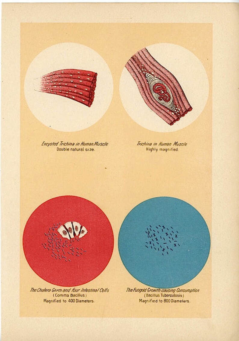 C. 1906 BACTERIA DISEASES PRINT antique medical lithograph | Etsy