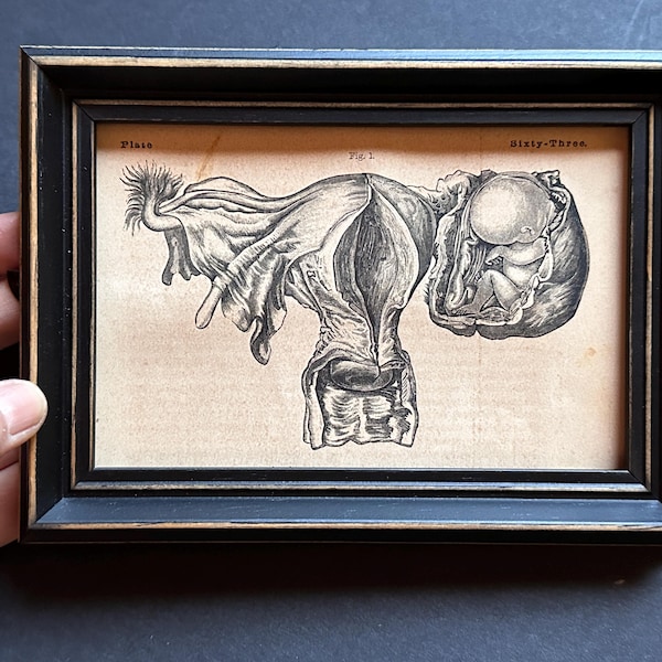 Fetus Antique - Etsy