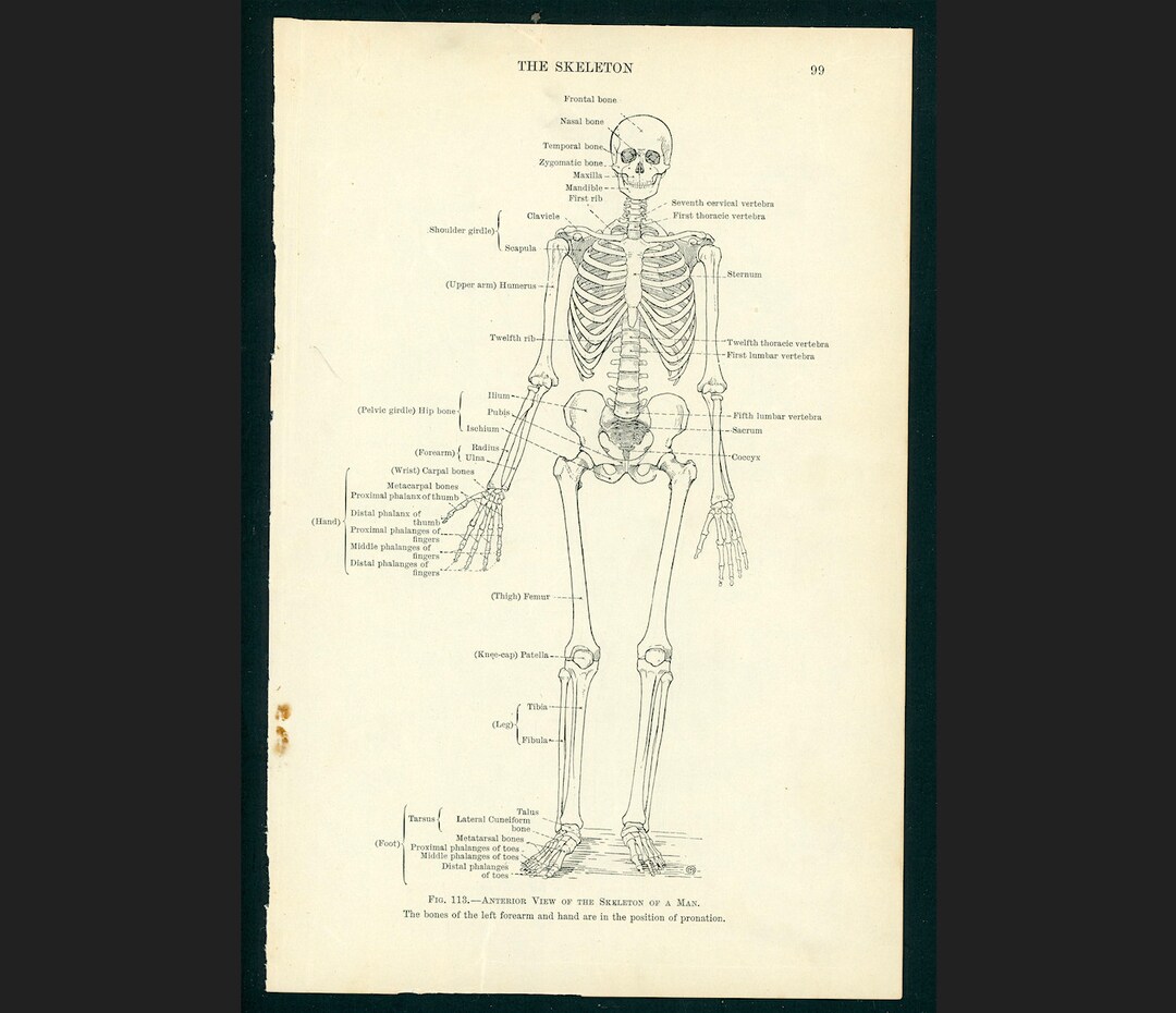 C. 1937 SKELETON • FRONT & BACK Lithograph • Original Vintage Print ...