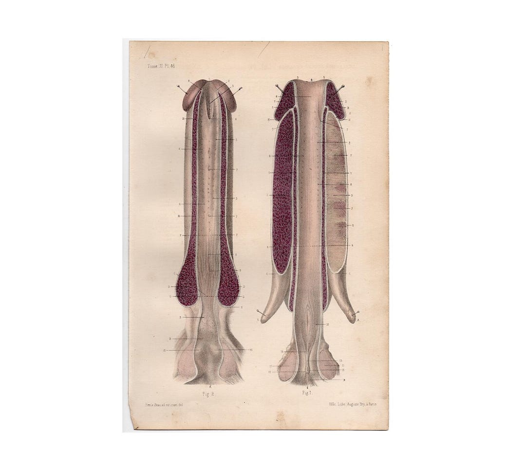 C. 1866 PENIS • HUMAN ANATOMY Print • Original Antique Print • Medical ...