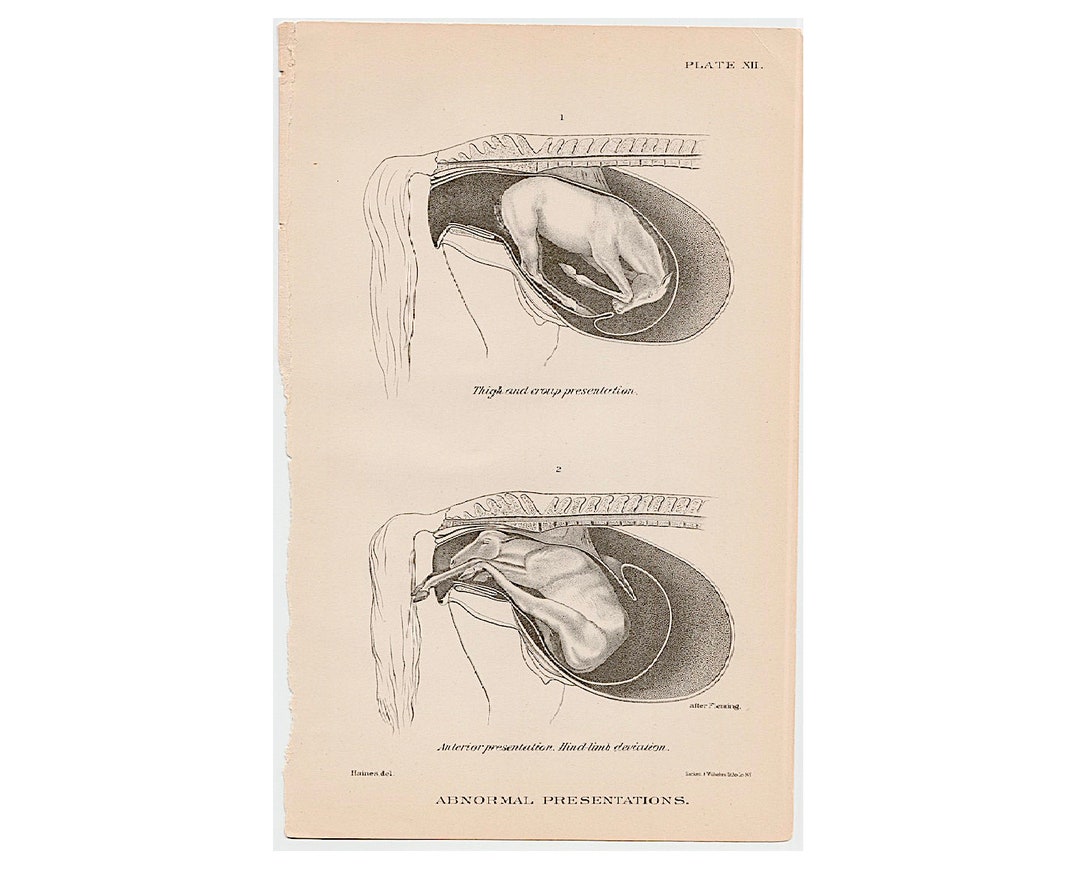 C. 1907 FOAL IN UTERO Lithograph • Original Antique Print • Horse ...
