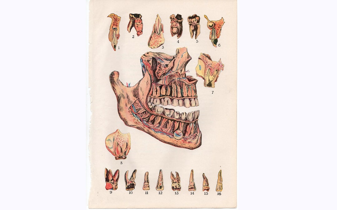 C. 1920 TEETH Lithograph Original Antique Print Dentist - Etsy