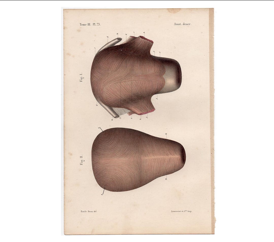 C. 1866 UTERUS • HUMAN ANATOMY Lithograph • Original Antique Print ...